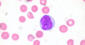 ¿Qué son los blastos? • DiarioCrónicas